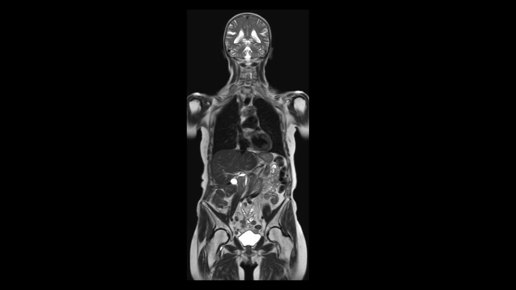 BioMatrix Contour Coils - Siemens Healthineers