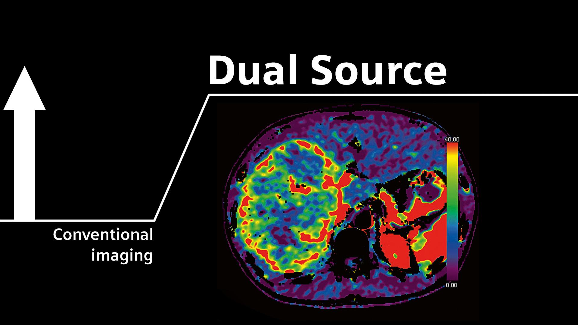Dual Source CT - Siemens Healthineers