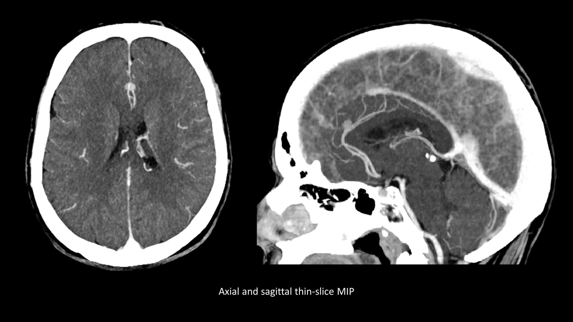 SOMATOM go.Up – Made to match - Siemens Healthineers USA