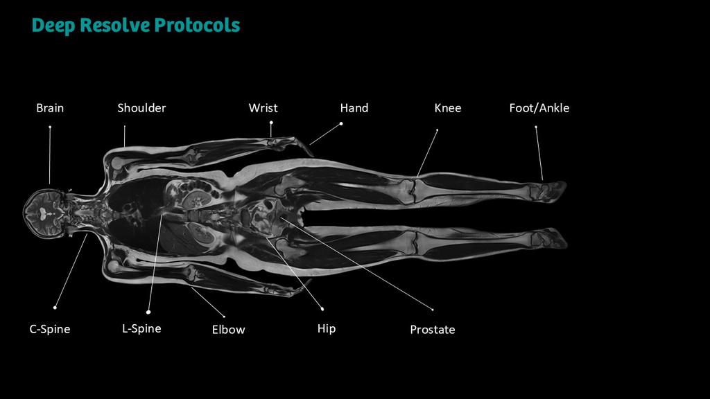 Unrivaled Speed in MRI: The Deep Resolve Protocols