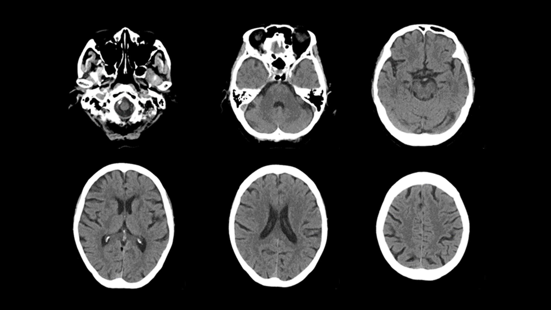 SOMATOM Drive - Siemens Healthineers USA