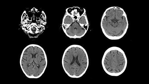 SOMATOM Drive eco – CT Scanner - Siemens Healthineers