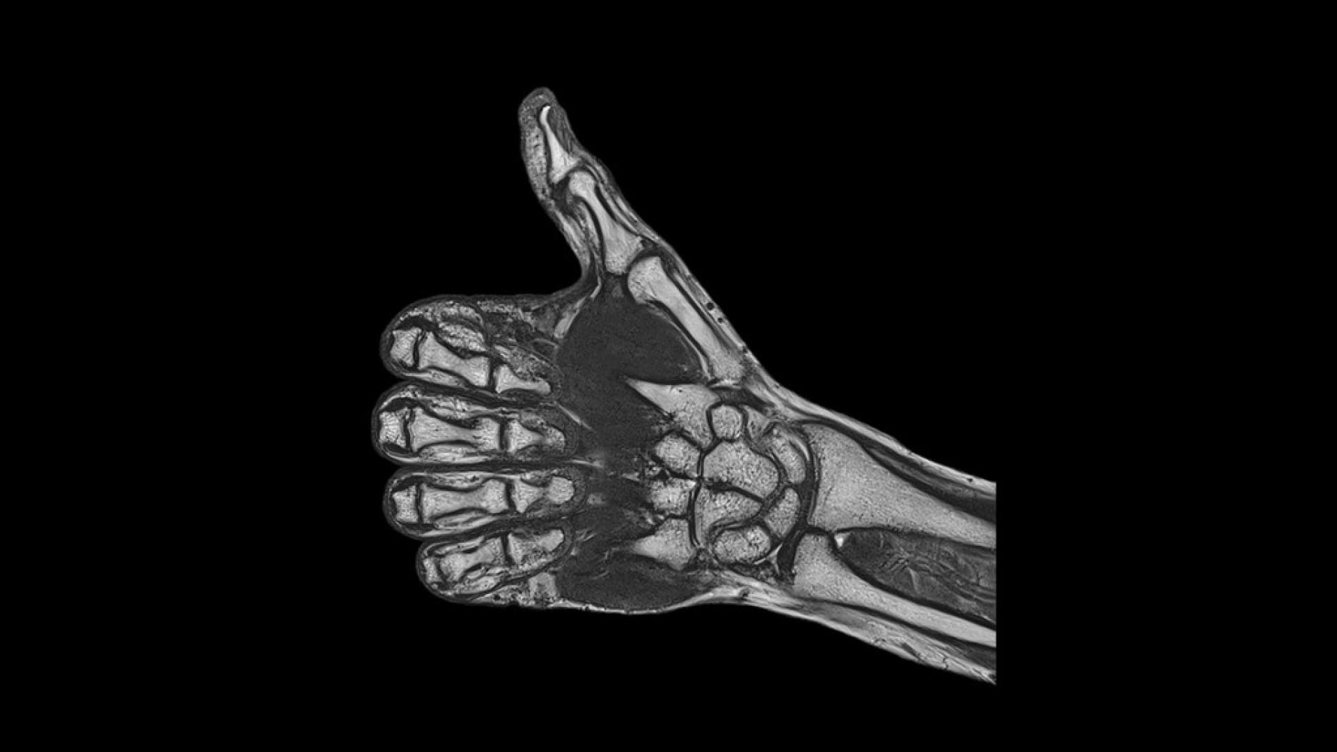 Musculoskeletal Imaging - Siemens Healthineers India
