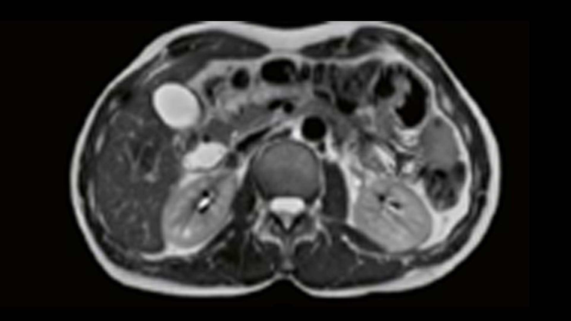 BioMatrix Technology - Siemens Healthineers