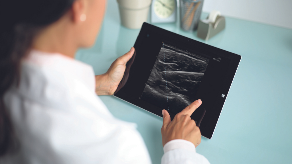 ACUSON Freestyle Wireless Ultrasound System - Siemens Healthineers