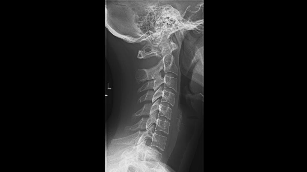 MULTIX Impact E - Siemens Healthineers