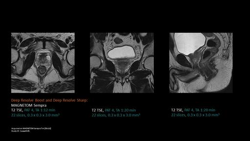 Deep Resolve - Siemens Healthineers
