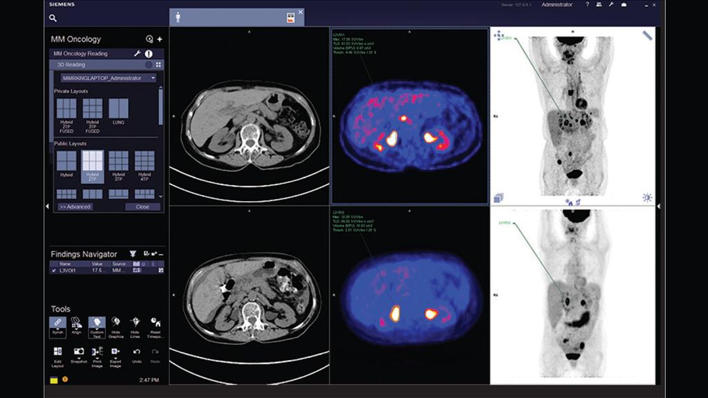 syngo.via pour l'Imagerie Moléculaire - Siemens Healthineers France