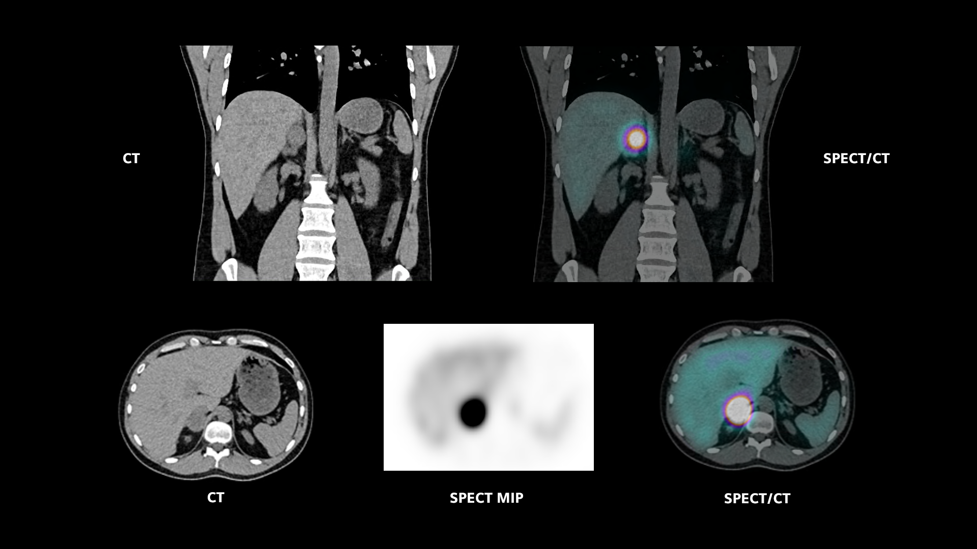 Symbia Pro.specta SPECT/CT - Siemens Healthineers Japan