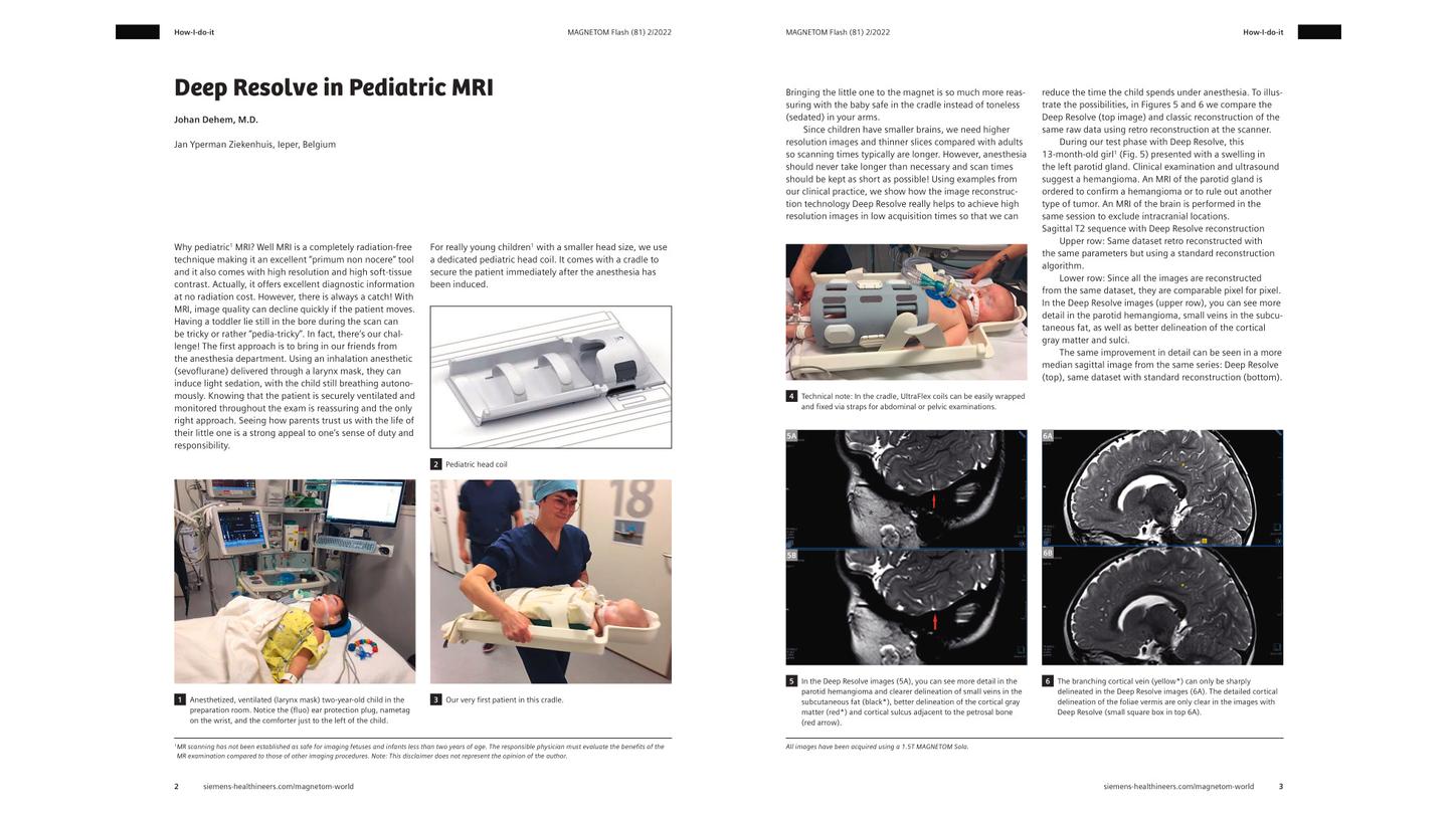deep resolve in pediatirc mri - pdf preview
