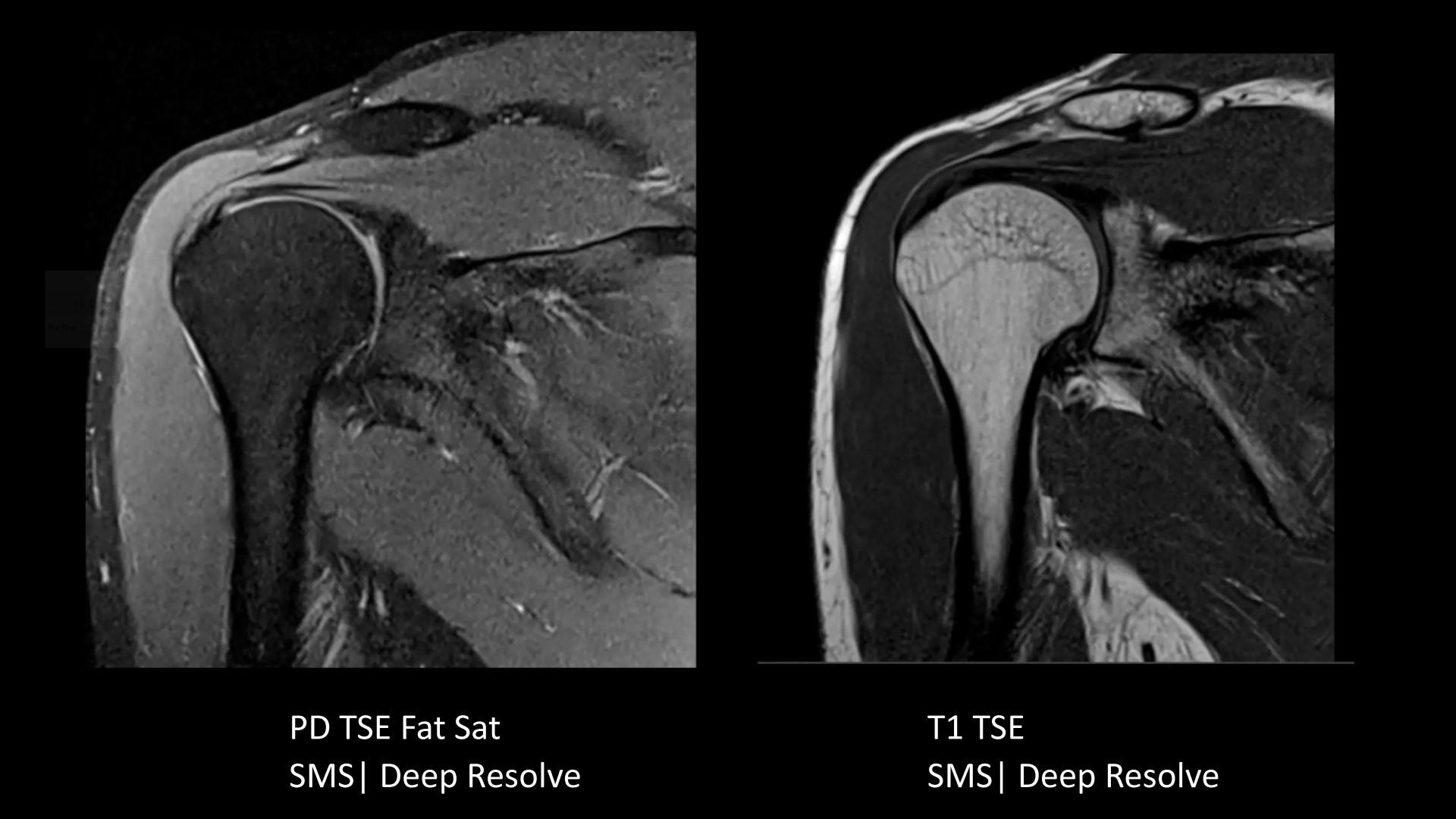 BioMatrix Contour Coils - Siemens Healthineers