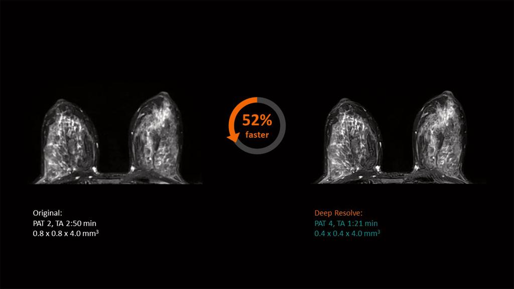 MAGNETOM Vida - Leading the field - Siemens Healthineers