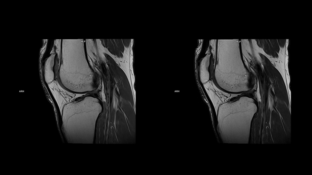 MAGNETOM Prisma - MRI Scanner - Siemens Healthineers