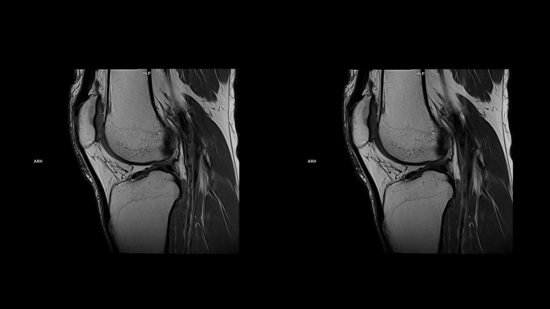 MAGNETOM Prisma - MRI Scanner - Siemens Healthineers