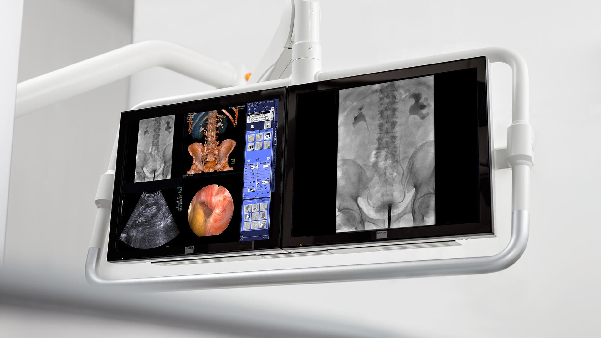 Urology device Uroskop Omnia Max - Siemens Healthineers USA