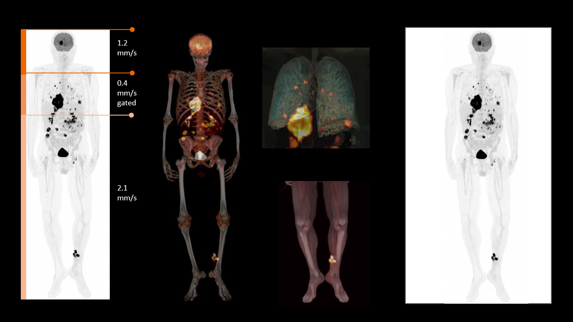 Biograph mCT PET/CT scanner - Siemens Healthineers