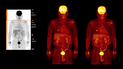 Biograph Horizon PET/CT scanner - Siemens Healthineers