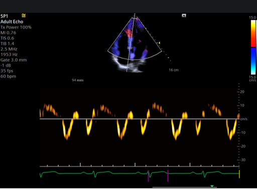 A New Era for Cardiac Imaging - Siemens Healthineers Singapore
