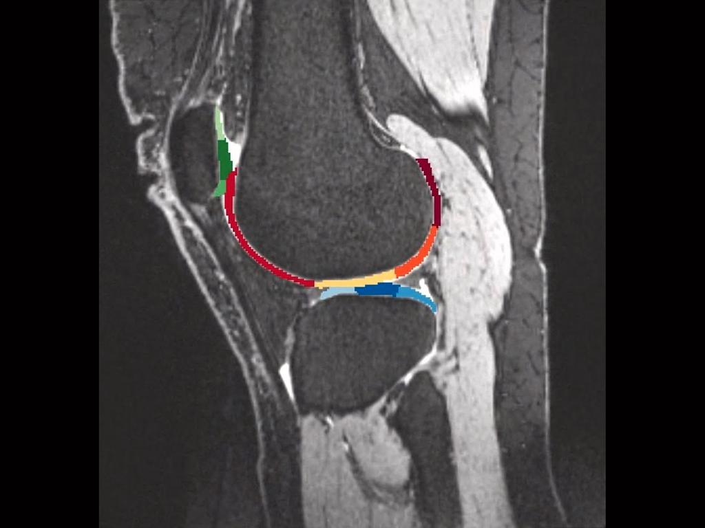 Clinical Imaging Solutions - MRI Applications - Siemens Healthineers