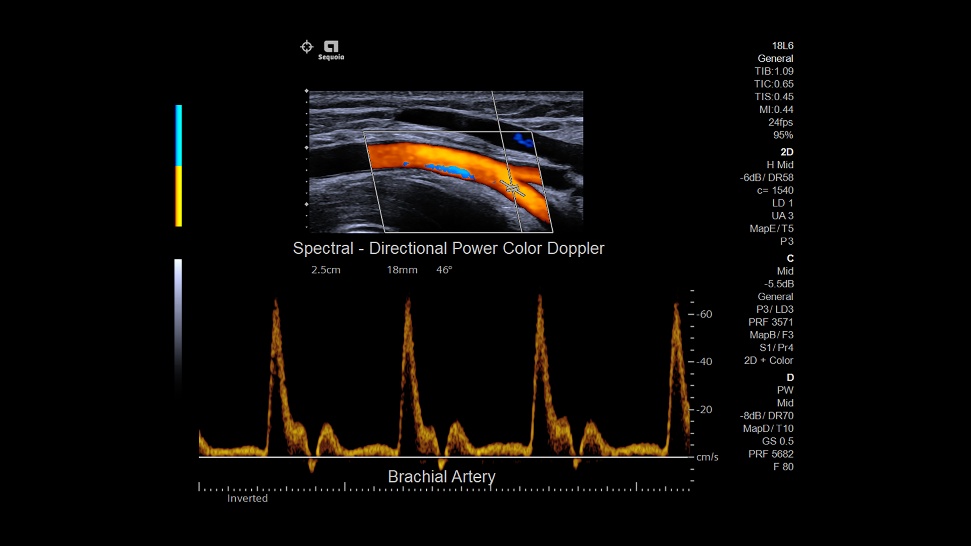 ACUSON Sequoia Ultrasound System - Siemens Healthineers