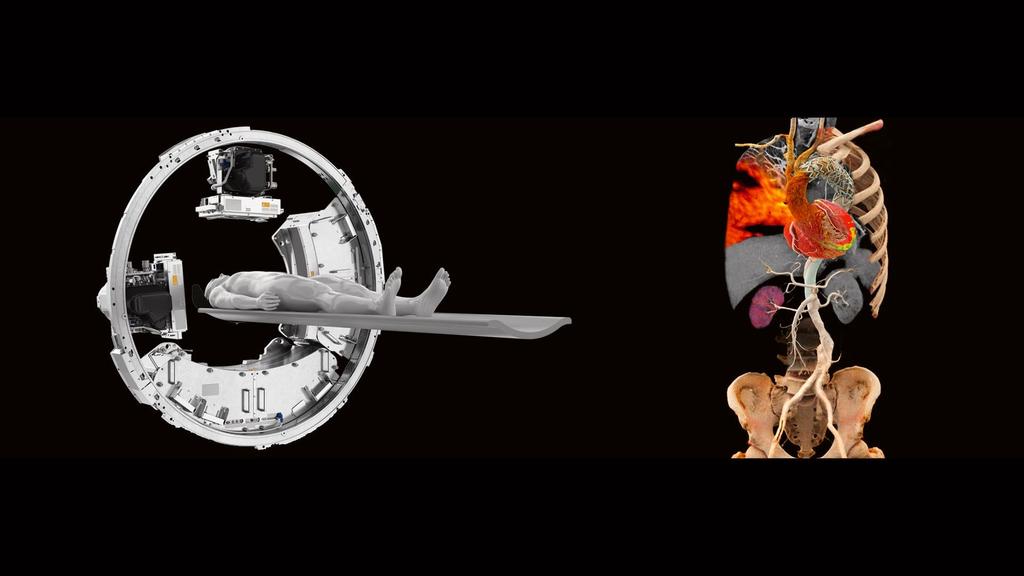 Dual Source CT and CT productivity - Siemens Healthineers USA