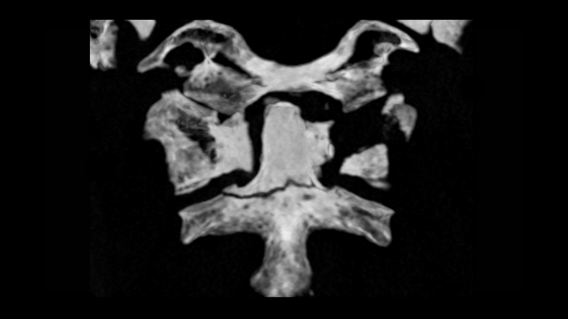 Computed Tomography - Siemens Healthineers