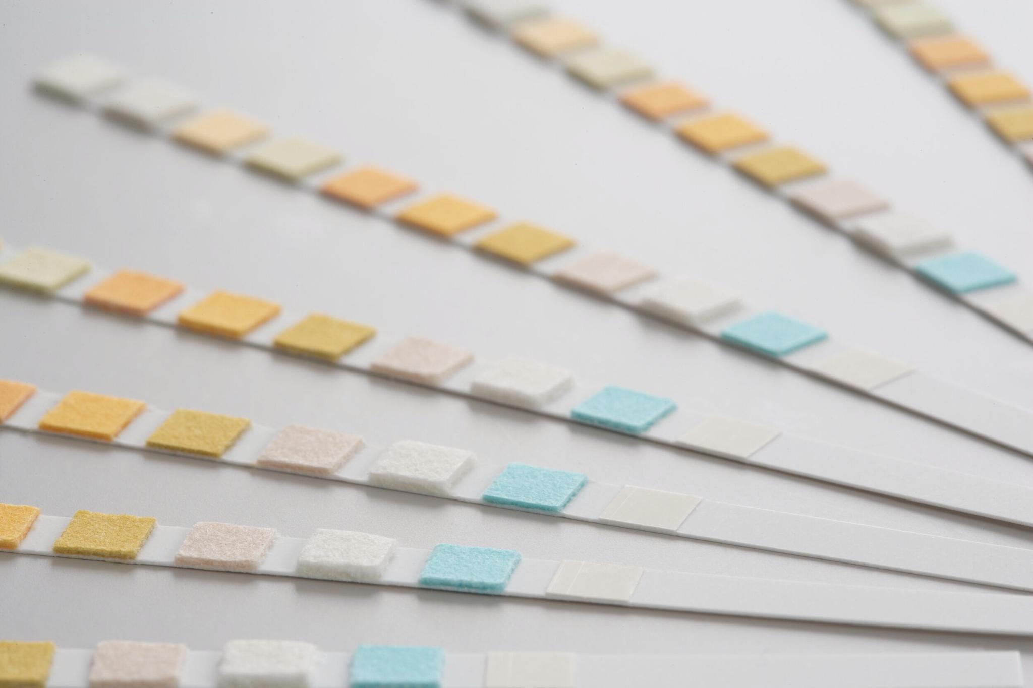 Urinalysis Products - Siemens Healthineers