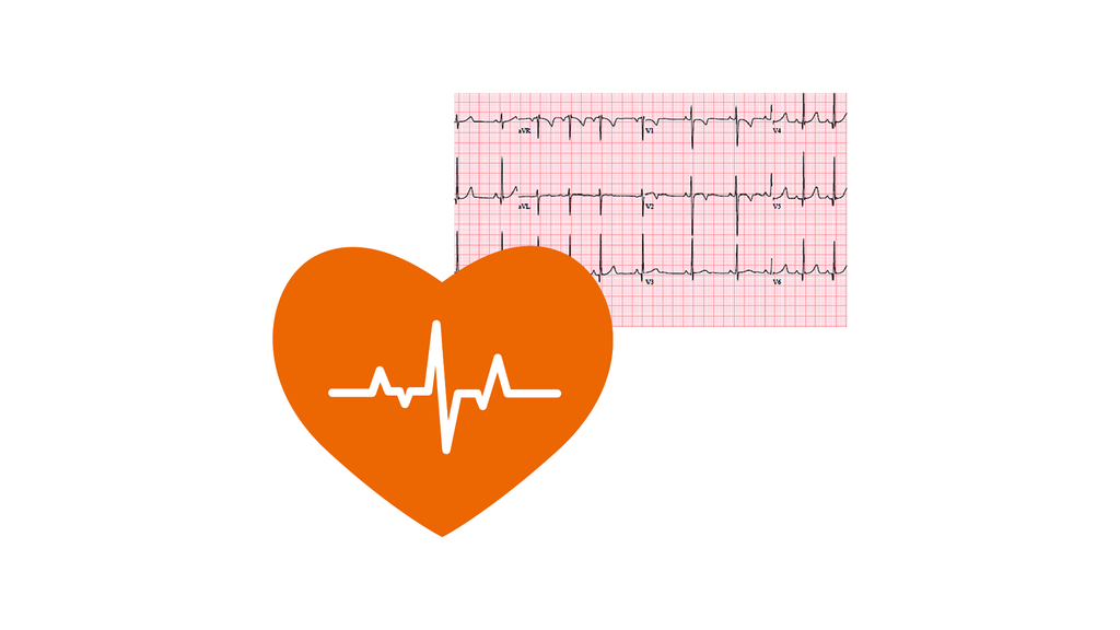 Media Kit: Atellica VTLi Patient-side Immunoassay Analyzer - Siemens ...