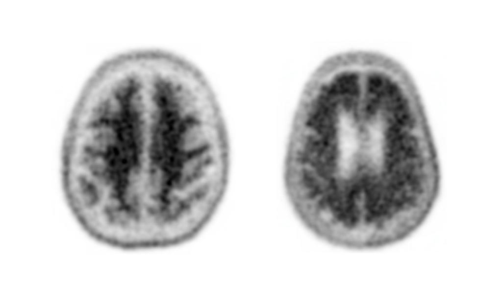 PETNET Solutions Inc. - Siemens Healthineers Vietnam