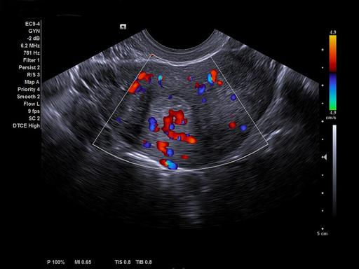 ACUSON NX2 Ultrasound System - Siemens Healthineers Vietnam