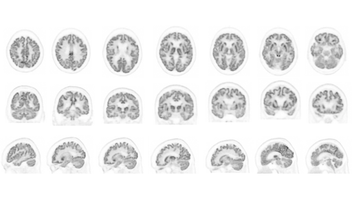 Biograph Vision PET/CT Scanner - Siemens Healthineers
