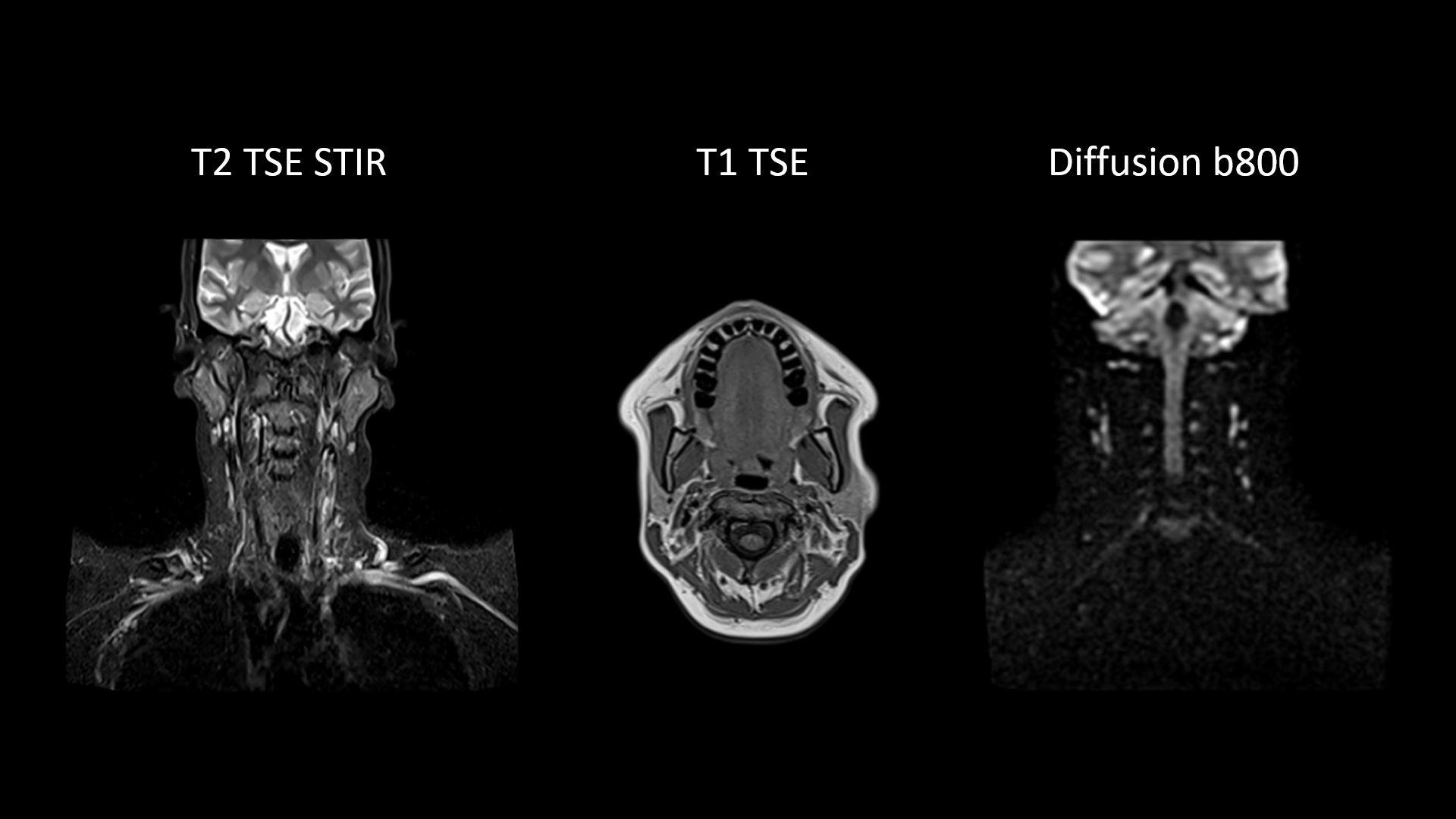 MAGNETOM Free.Max – MRT mit größerer Öffnung – Siemens Healthineers ...