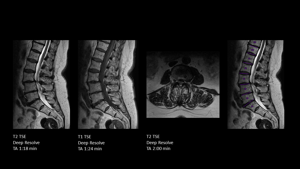 MR imaging in sports medicine - Siemens Healthineers