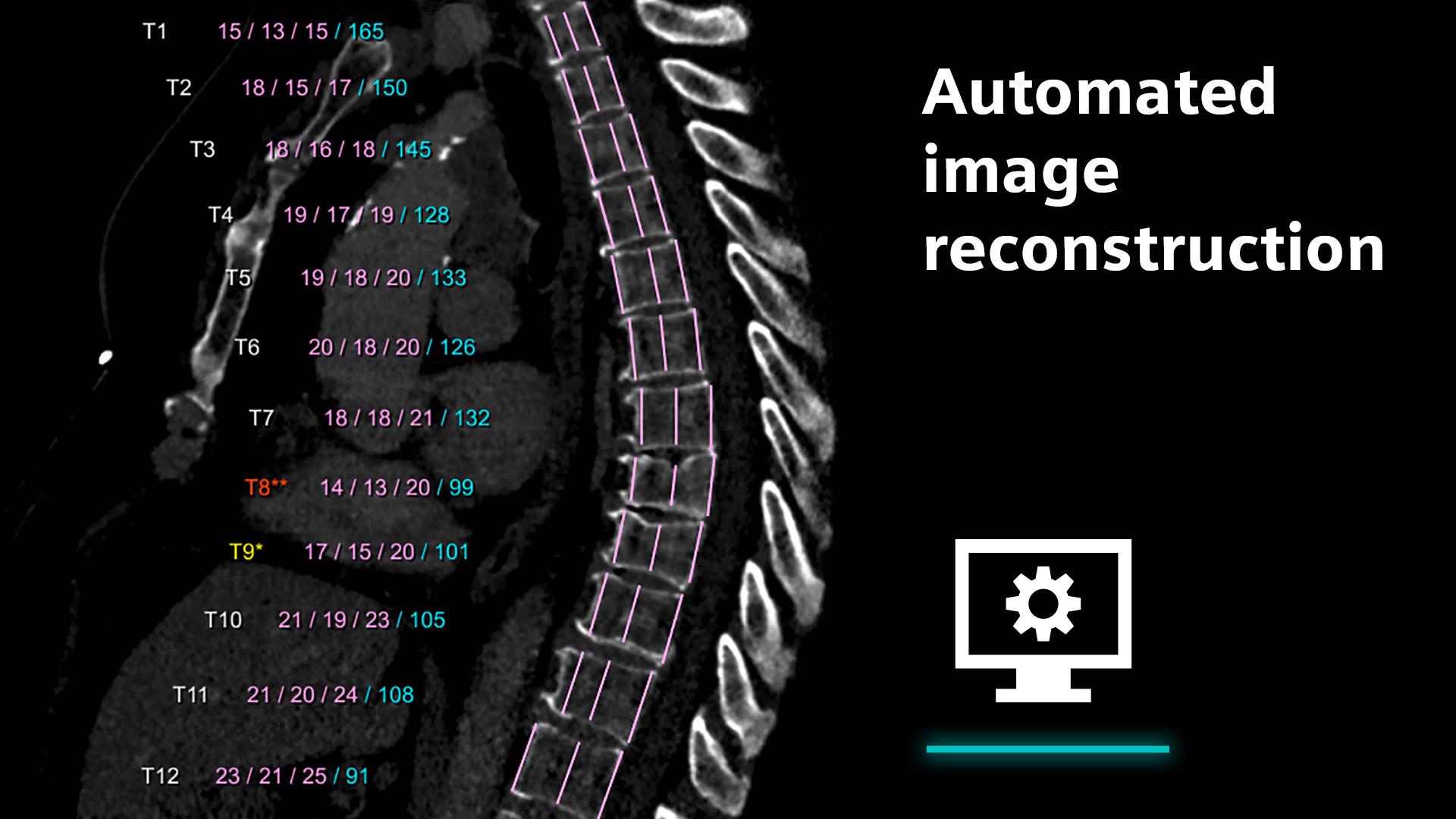AI-powered Productivity in Photon-counting CT | NAEOTOM Alpha class ...