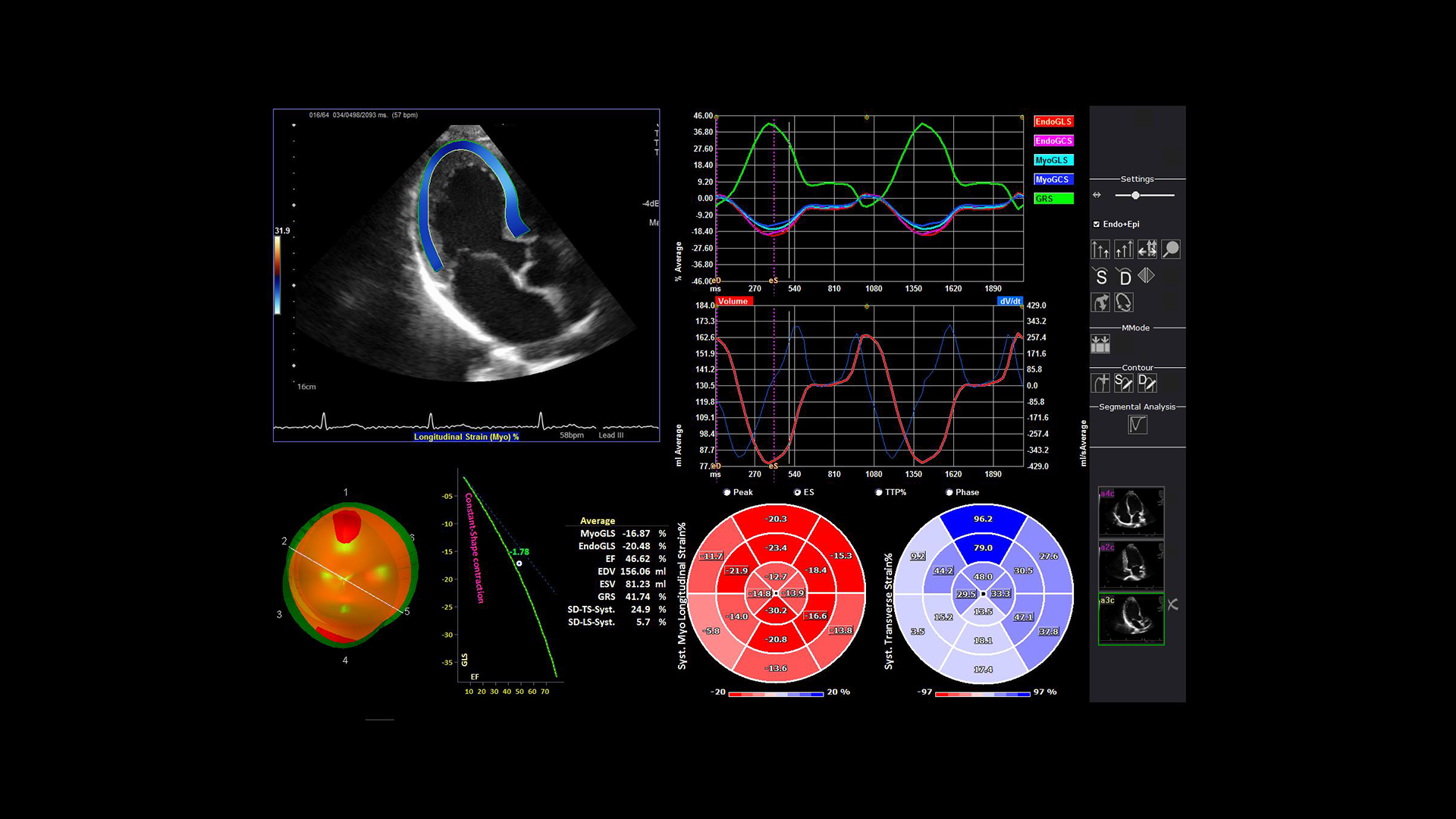 ACUSON Sequoia Ultrasound System - Siemens Healthineers