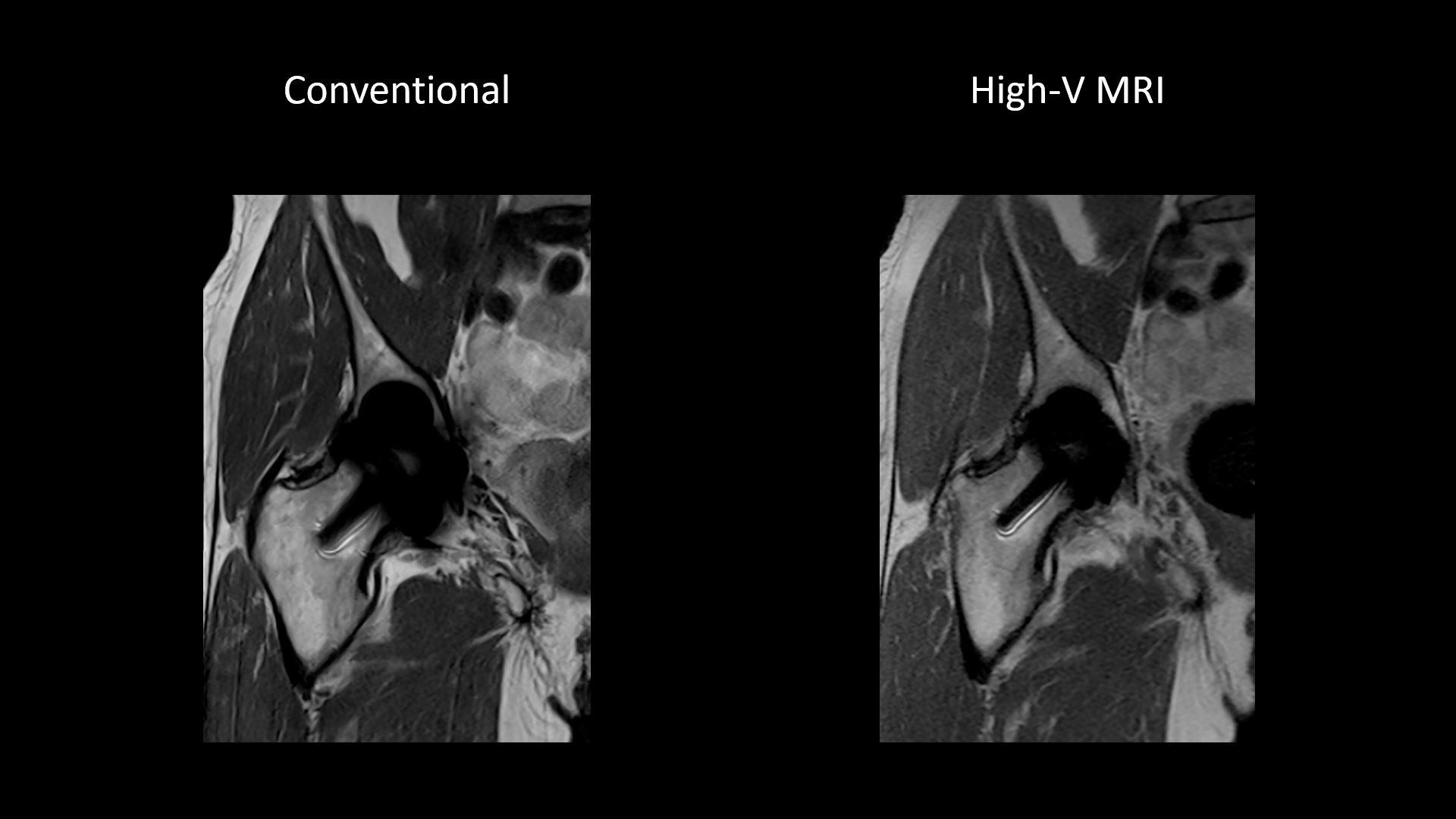 MAGNETOM Free.Max – Open Bore MRI - Siemens Healthineers USA