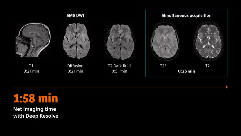 Deep Resolve - Siemens Healthineers