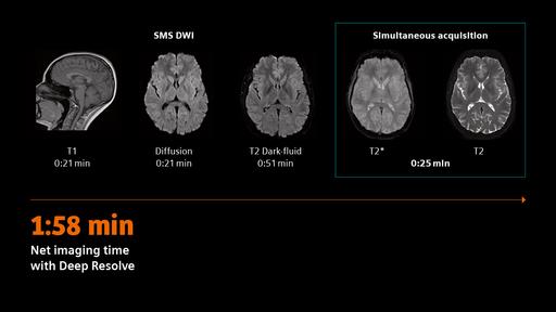 Deep Resolve – Siemens Healthineers Deutschland