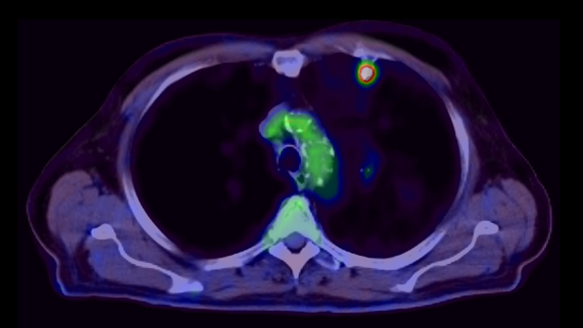 Biograph PET/CT family - Siemens Healthineers