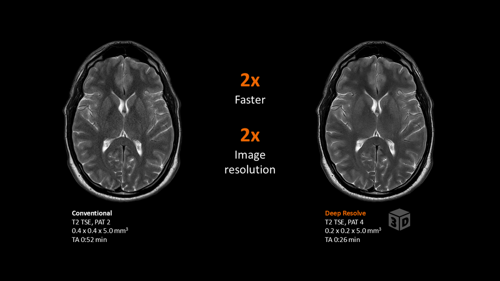 MAGNETOM Altea 新時代に求められる生産性と再現性 - Siemens Healthineers Japan
