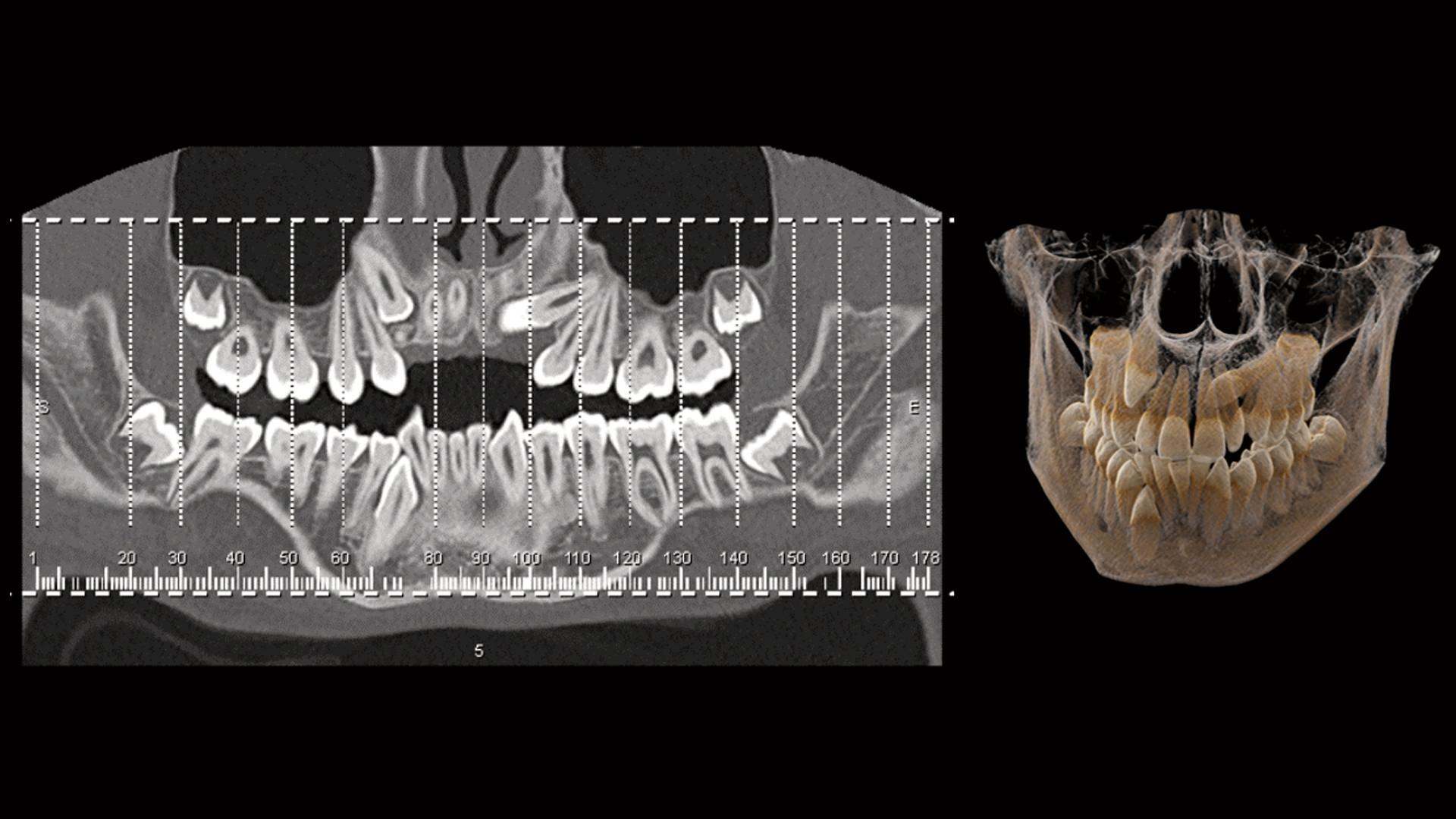 The Siemens Healthineers CT Imaging Chain - Siemens Healthineers