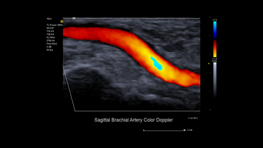 ACUSON Juniper, CV Edition Ultrasound System - Siemens Healthineers