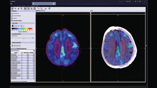 syngo.via for MI - Siemens Healthineers