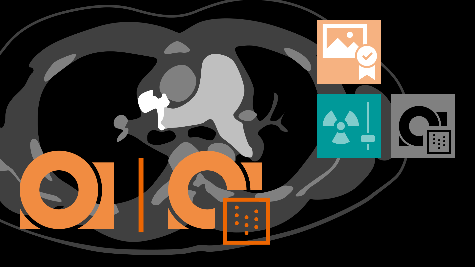 Improved pulmonary artery evaluation using high-pitch photon-counting ...