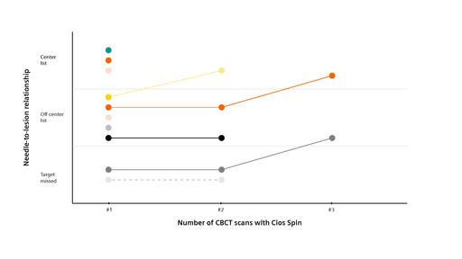 Image-guided robotic bronchoscopy - Siemens Healthineers USA