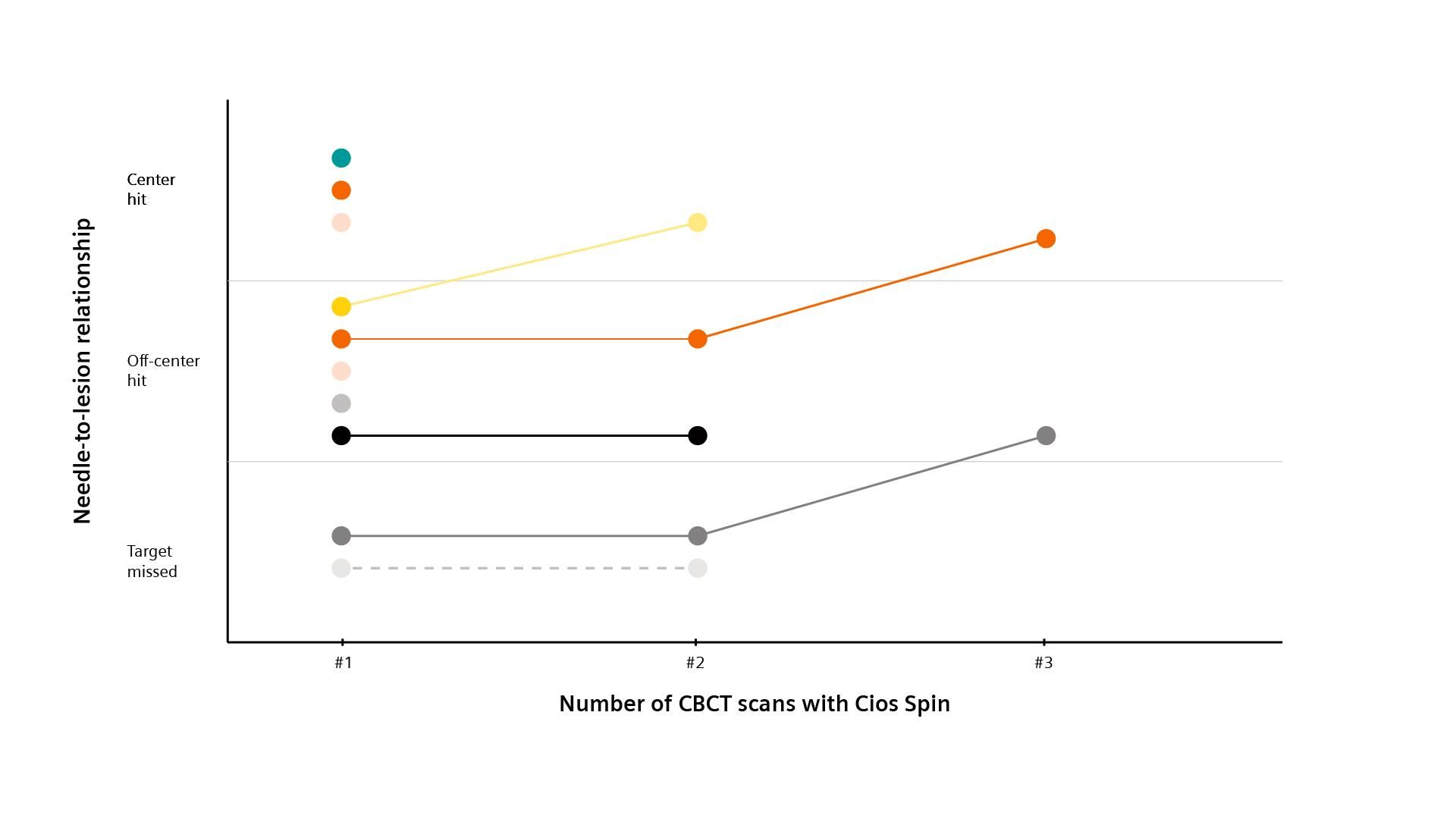 Image-guided robotic bronchoscopy - Siemens Healthineers USA