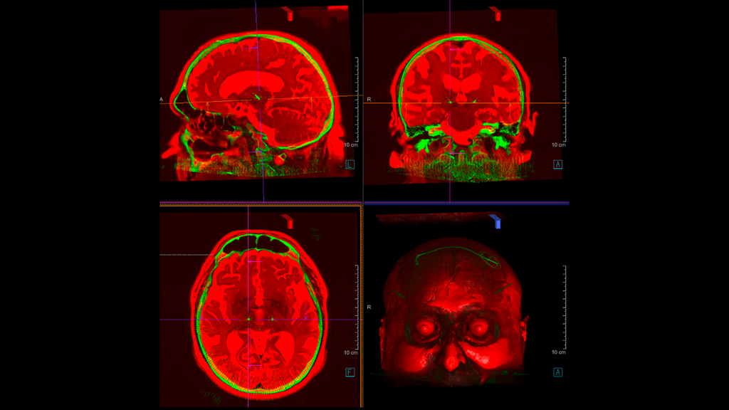 ARTIS pheno - Siemens Healthineers