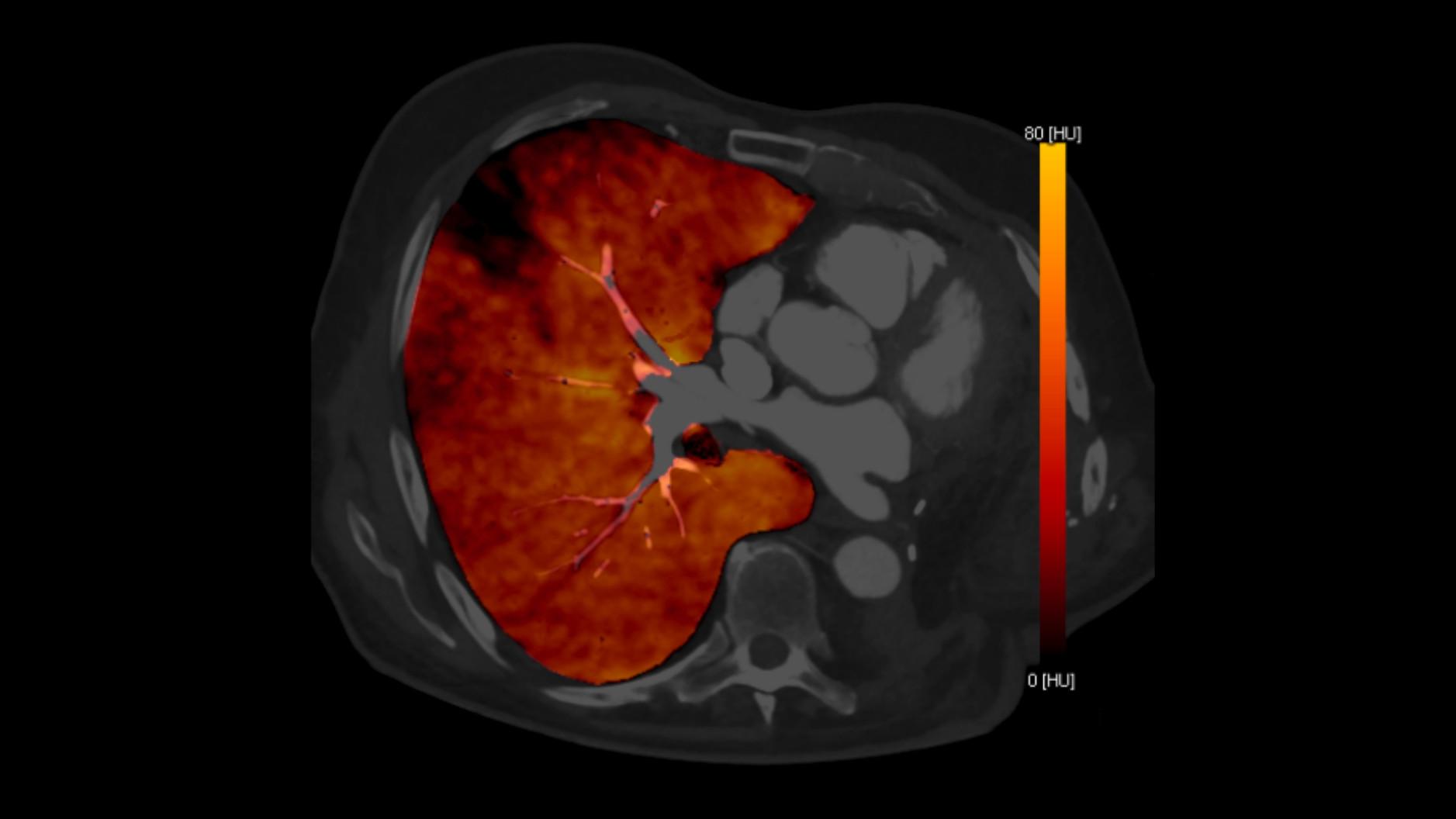 CT Imaging Chain - Siemens Healthineers USA
