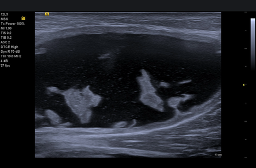 MSK Ultrasound