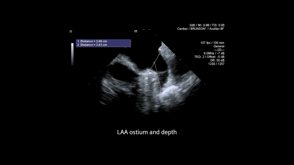 Cardiovascular Ultrasound | ACUSON SC2000 Ultrasound System - Siemens ...